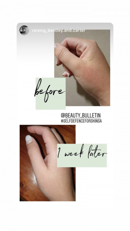 - SBR Repair 100g Review - Beauty Bulletin - Moisturizers,Day Creams ...