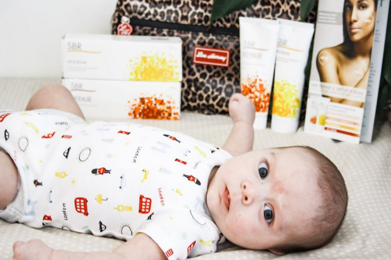 - SBR Repair 100g Review - Beauty Bulletin - Moisturizers,Day Creams ...